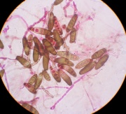 Parasitic Infections - Health Facts